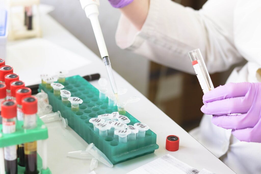 Coronavirus: additional €122 million for research and innovation | CDE ...